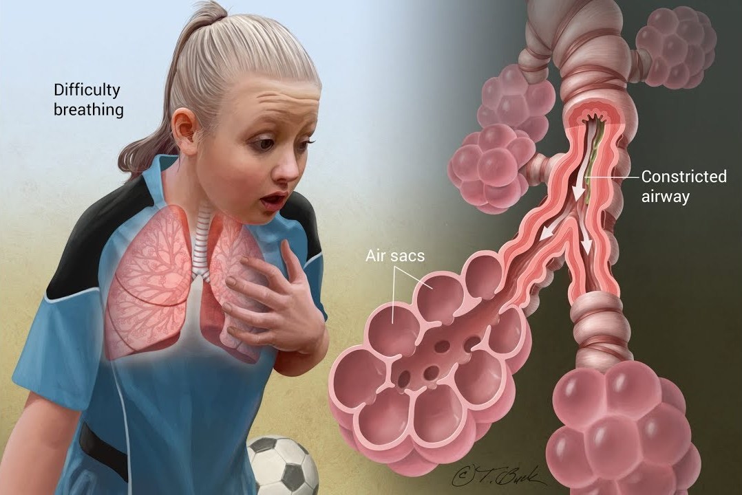 E cigarettes May Cause Wheezing In Adults Study OrissaPOST